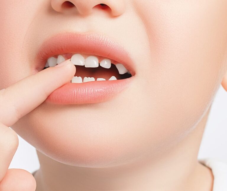 Pediatric Crowns in Boise | Idaho Kids Dentistry & Orthodontics
